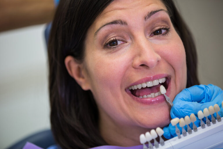 Dental Bonding vs Veneers: Which Is Right for You? - Sapphire Dental Centre